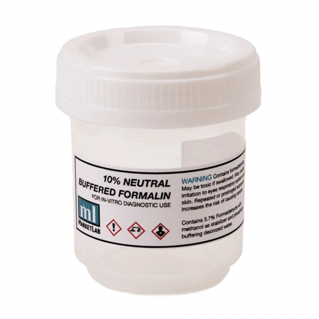 Buy Marketlab 58521, Prefilled Formalin (NBF) Jars 60 mL - Prime Lab Med